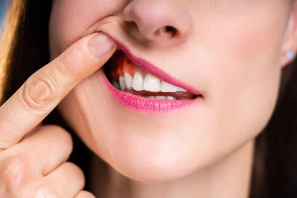 Pus or Swelling Around a Tooth: Is It an Emergency?